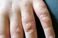 5 Safety Hazards In The Laboratory